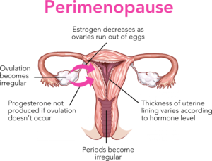 Natural Menopause and Perimenopause TCM Treatment | Ponsonby Wellness Centre